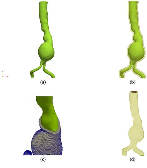 Flow In The Descending Aorta With Aneurysm Example A Immersed Download Scientific Diagram