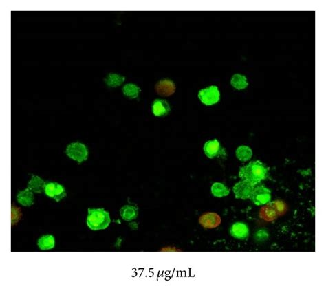 Fluorescence Confocal Imaging Of Tunel Positive Staining In Hepg2 Cells