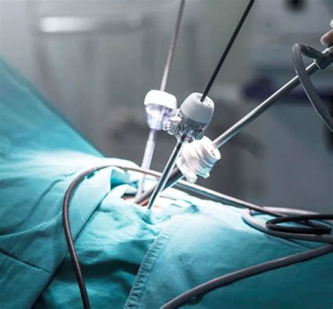 Robotic Pyeloplasty For Urinary Tract Treatment In Kochi