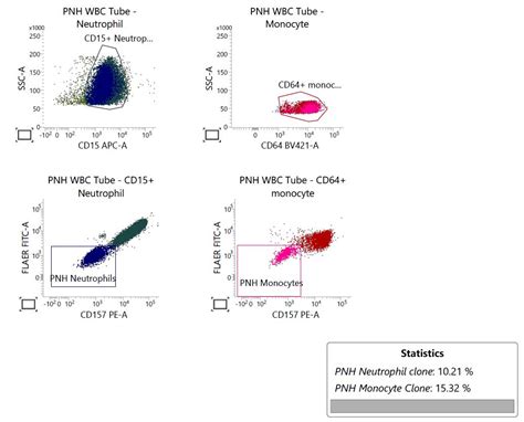 Aplastic Anemia Life Expectancy In Elderly Kiesha Mcclendon