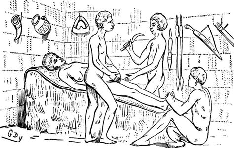 Blunderbuss Did You Know That Modern C Sections Were Invented