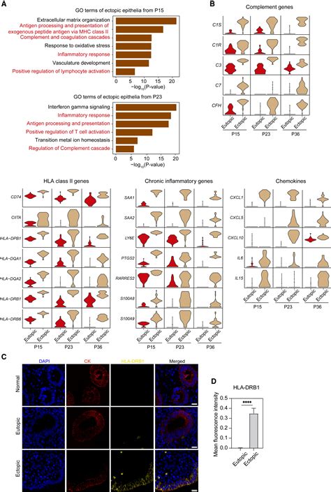 Single Cell Analysis Reveals Insights Into Epithelial Abnormalities In