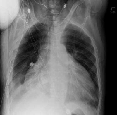 Imagenología del Corazón y Grandes Vasos Concise Medical Knowledge