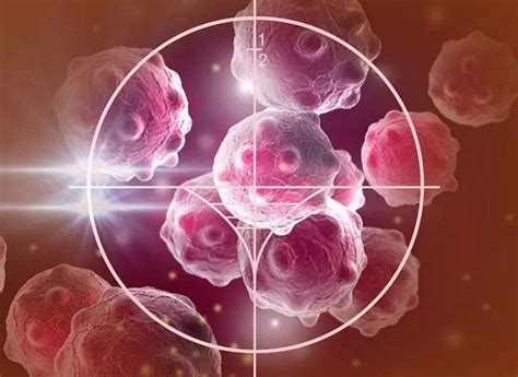 为什么癌症往往一发现就是晚期？ 知乎