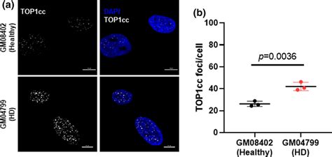 Hd Patient Derived Fibroblasts Show Increased Top1cc Levels After Cpt