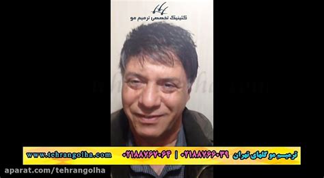 ترمیم مو کاشت مو روش انحصاری های فیکس آلمان گلهای تهران
