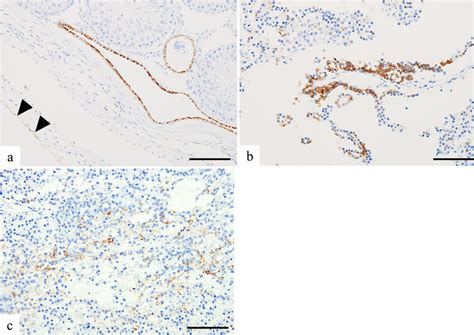 Immunohistochemistry For Cytokeratin 7 In An Intact Testis And In The