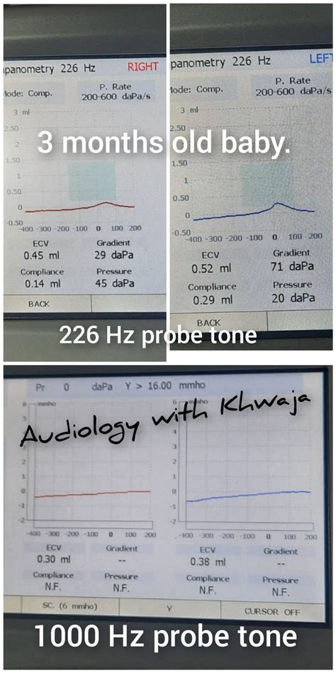 Khwaja Moinudeen On Linkedin Choosing A Wrong Probe Tone Can Mislead