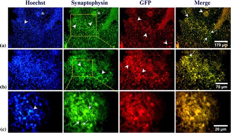 Representative Fluorescence Micrographs Show In Ovo Fate Of The