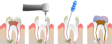 Endodontia Clínica Vila Do Sorriso