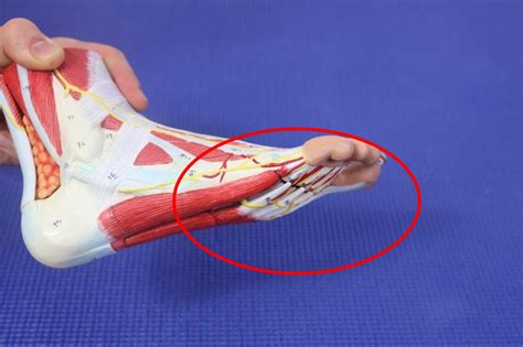 What Causes Toes To Curl Up Toes Cramping And Curling How To Fix It