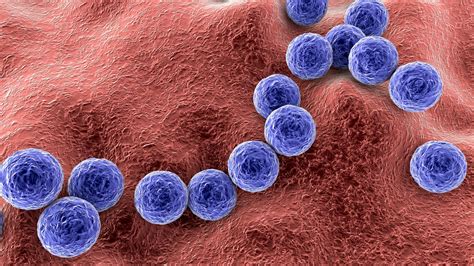 The Outcome Of Invasive S Pyogenes Infection Is Regulated By An