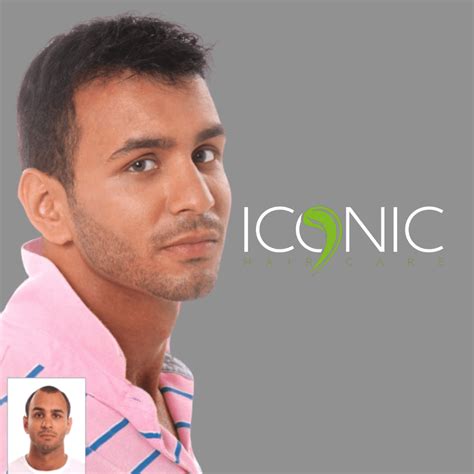 تركيب الشعر دبي أبوظبي ايكونيك هير كير