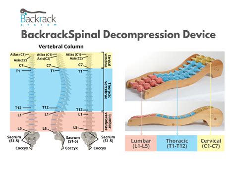 Sacral Bone Pain Causes Treatment And Anatomy Of Sacrum