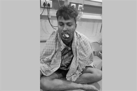 लागूऔषध ओसारपसार गर्ने समूहबीच गोली हानाहान एक युवक घाइते कमल रिमाल