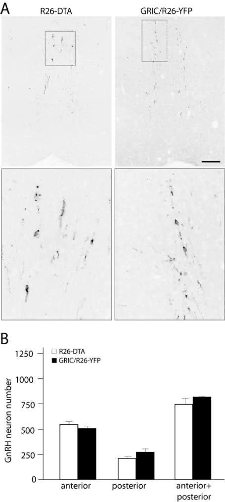 15 Gnrh Neuron Numbers In The Hypothalamus Of Gricr26 Yfp And R26 Dta