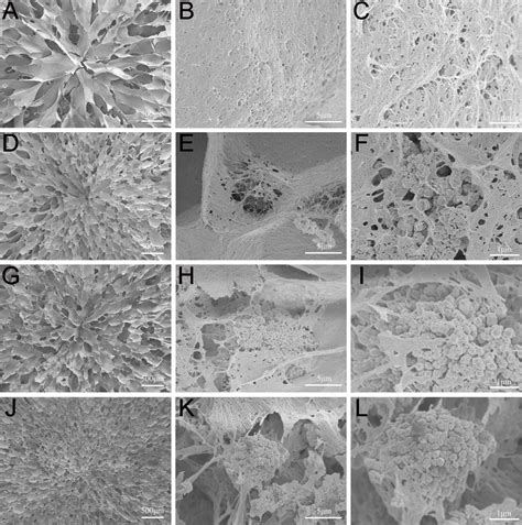 浙江大学王征科课题组：多层次结构、高矿物含量支架材料在骨修复中的应用中国聚合物网科教新闻