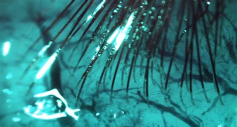 Elon Musk Showcases Advances In Elusive Neuralink Brain Implant
