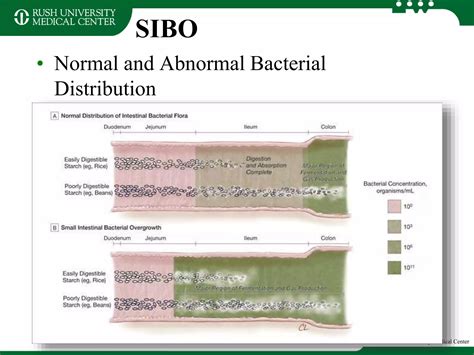 Scleroderma Systemic Sclerosis And The Gi Tract Ppt