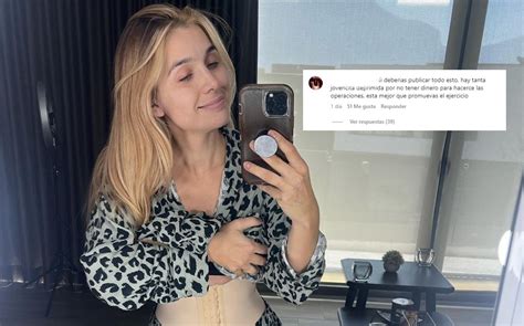 Marcela Mistral La critican por mostrar proceso tras cirugía estética