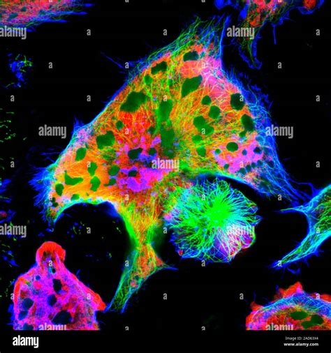 Neuroblastoma Cells Fluorescence Light Micrograph Of Cells From A Type Of Brain Cancer