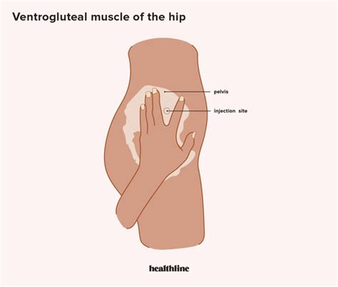 Ch 37 Administering Intradermal Subq Intramuscular Injections Flashcards Quizlet