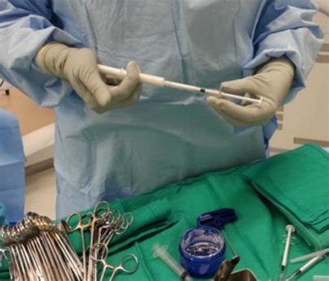 Subchondroplasty Of The Ankle A Novel Technique The Foot And Ankle Online Journal