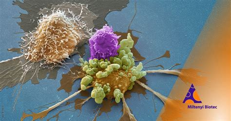 Demisha Patel Auf Linkedin Cartcelltherapy Future Immunotherapy