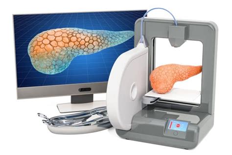 What Is An Artificial Pancreas Who Makes It And The Cost