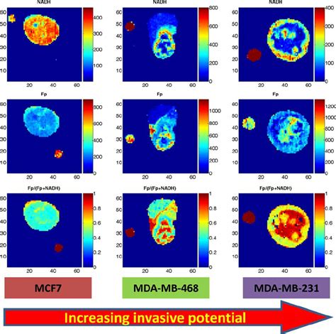 The Typical Redox Images Nadh Fp The Fp Redox Ratio Of Three Breast