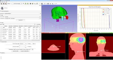 Documentation Extensions Slicerrt Slicer Wiki