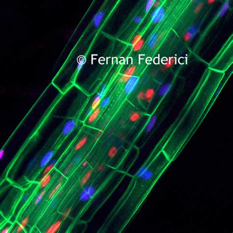 Microscope World — Plant Tissue Fluorescence Proteins Captured With