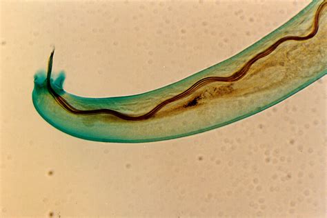 In Hawaii Rat Lungworm Disease Infects People But Eludes Researchers
