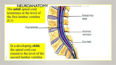 Solution Dislocation Of Vertebral Column Lec 3 4 Studypool