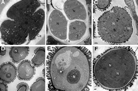 Transmission Electron Micrographs Of Pollen Development In Fertile
