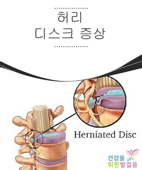 Pin On 건강한 습관