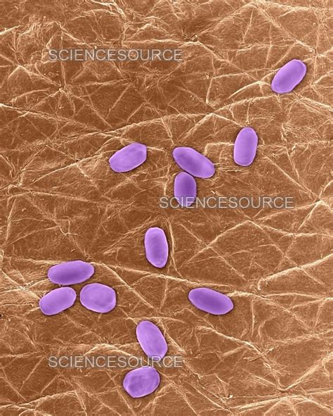 Bacillus Anthracis Spores Sem Stock Image Science Source Images