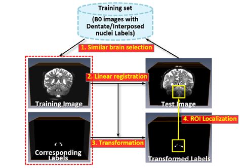 Efficient Roi Localization Based On The Anatomical Similarity During