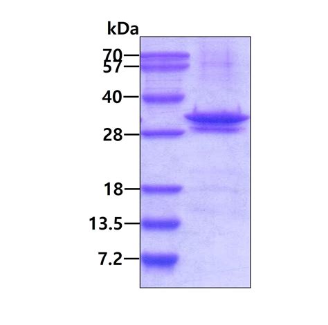 Purine Nucleoside Phosphorylase Activity Assay试剂盒fluorometric Abcam中文官网