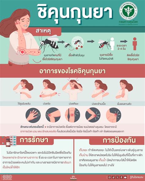 กรมควบคุมโรค 🦟 เตือน โรคไข้ปวดข้อยุงลาย ชิคุนกุนยา ระบาดช่วงฤดูฝน ระวัง “ไข้ปวดข้อยุงลาย