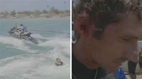 Jackass Stars Steve O Chris Pontius Jet Ski Accident Caught On Camera