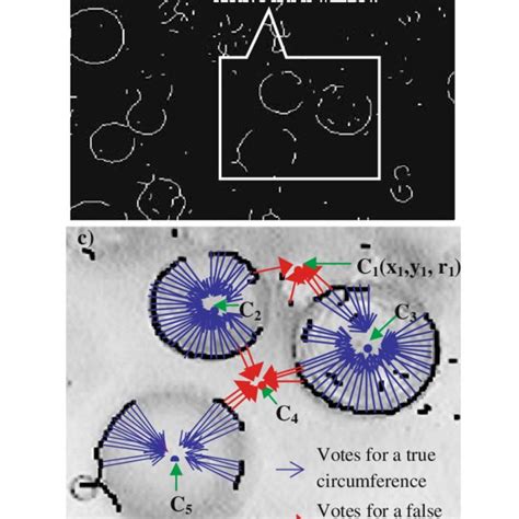 The Segmentation Process Using The Improved Hough Transform Download Scientific Diagram