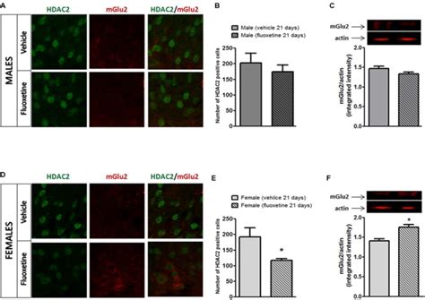 Chronic Treatment With Fluoxetine Induces Sex Dependent Analgesic