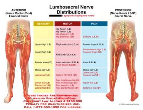 Nerve Root Ablation