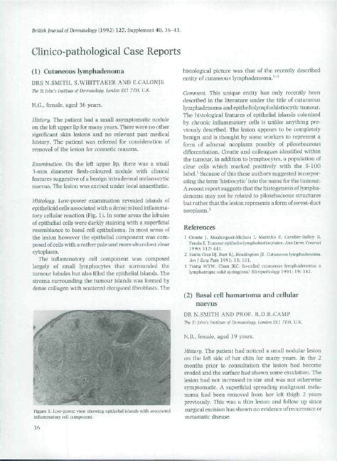 Pdf 1 Cutaneous Lymphadenoma Sean Whittaker