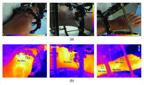 pin site detection results in bounding boxes with confidence scores
