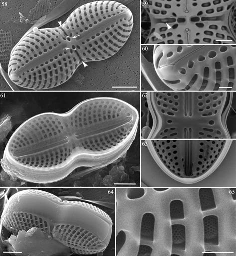 Diploneis Weissflogii Sem Fig 58 External Valve View Showing