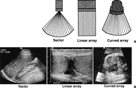 Ultrasound Basicsgetting Started Ultrasound Ultrasound School