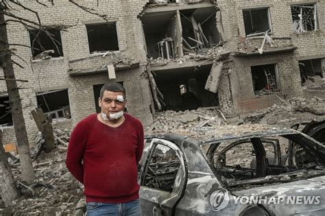 러군 포격에 파괴된 건물 앞에 서있는 다친 우크라 시민 연합뉴스
