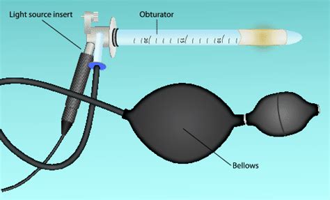 E3 Proctoscopy And Rigid Sigmoidoscopy Springerlink